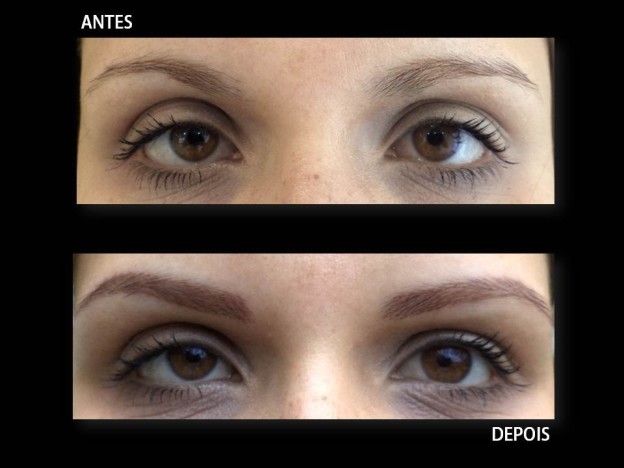 Sobrancelha Fio A Fio Cuidados Recomendações E O Que é A Técnica